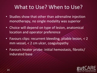 Endoscopic Hemostasis - for Endoscopy Nurses | PDF