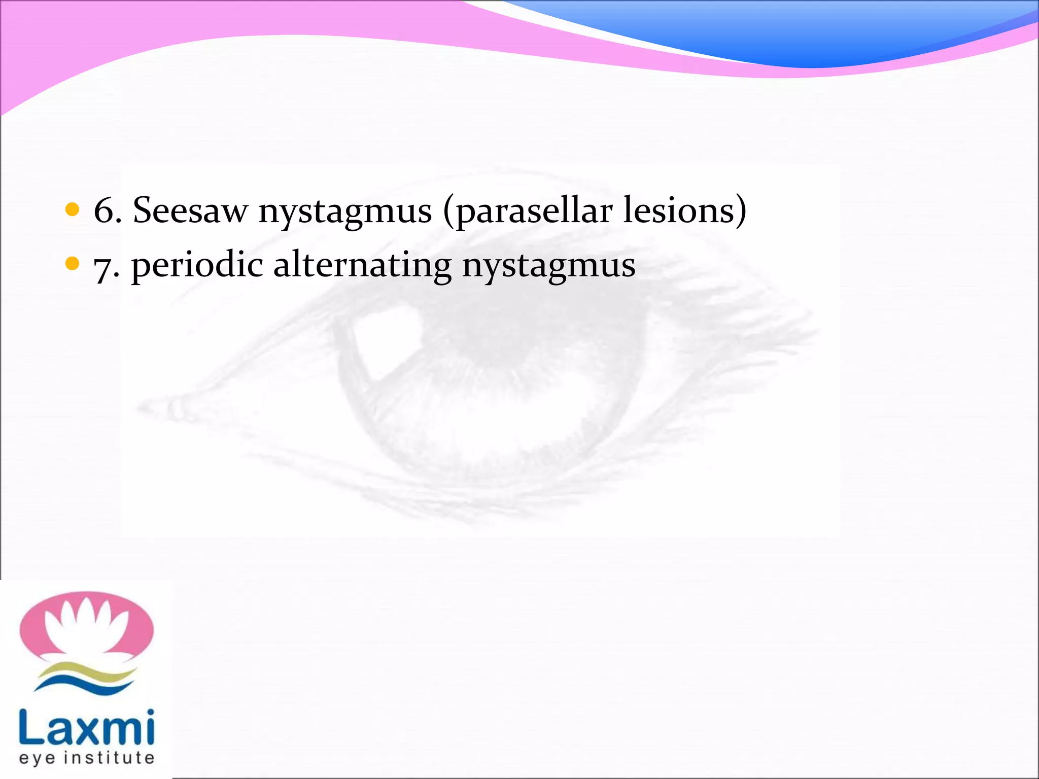 Nystagmus | PPTX