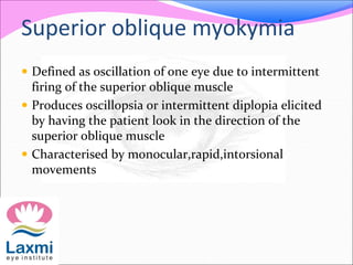 Nystagmus | PPTX