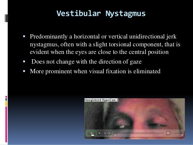 Nystagmus