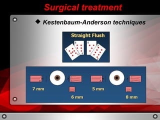 Nystagmus | PPT