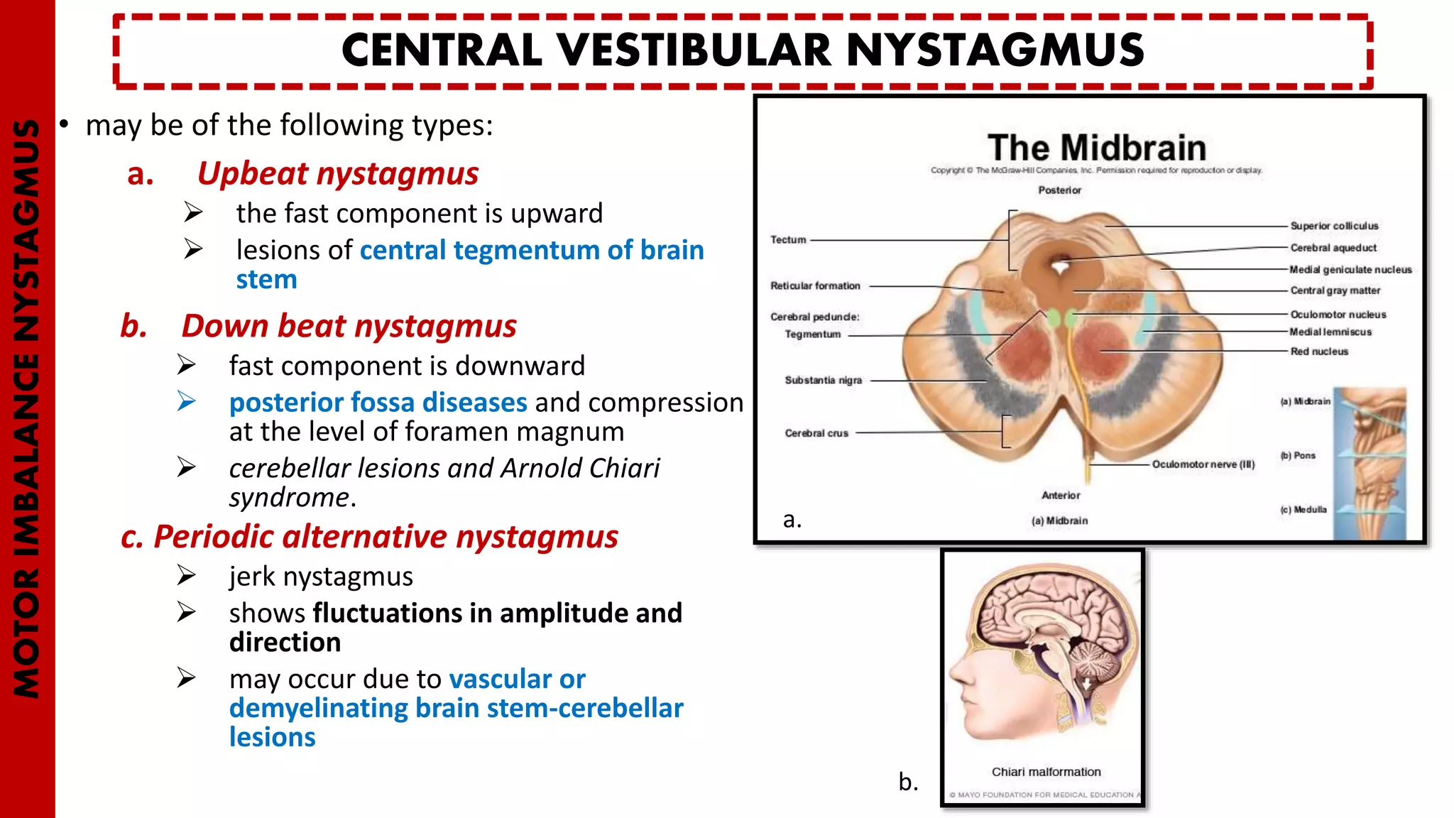 Nystagmus | PPTX