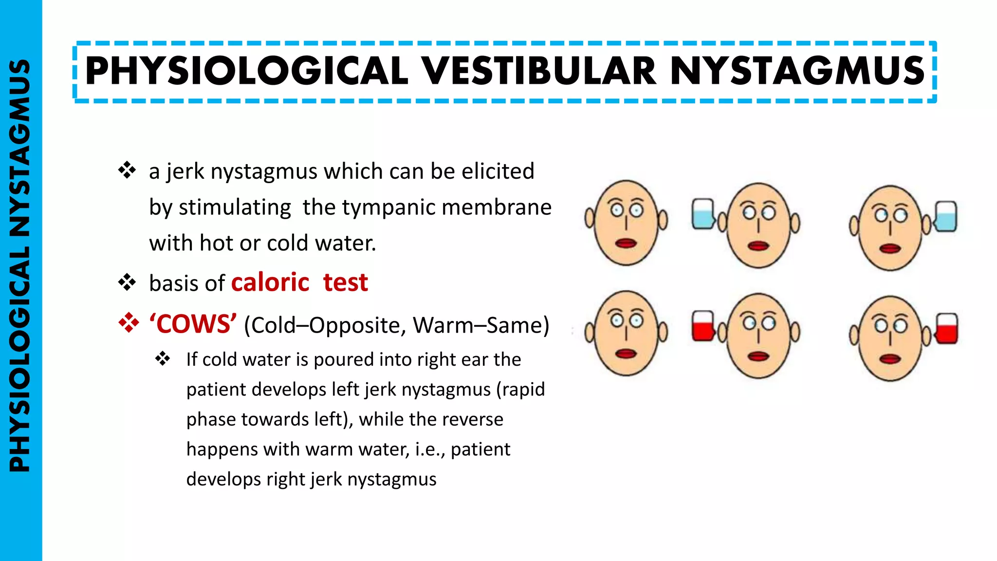 Nystagmus | PPTX