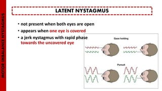 Nystagmus | PPTX