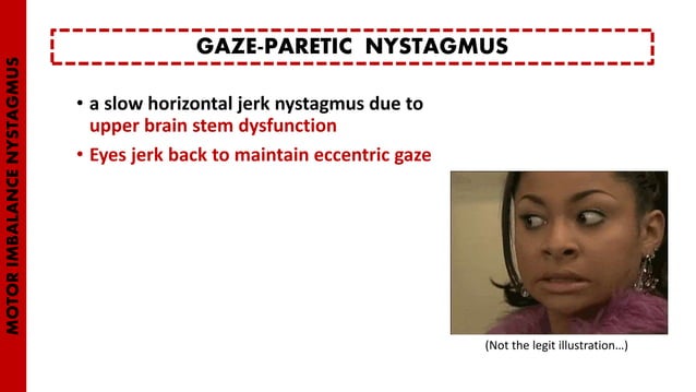Nystagmus | PPTX | Eye and Vision Conditions | Diseases and Conditions