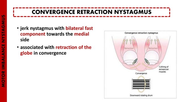 Nystagmus | PPTX | Eye and Vision Conditions | Diseases and Conditions