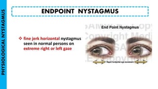 Nystagmus | PPTX