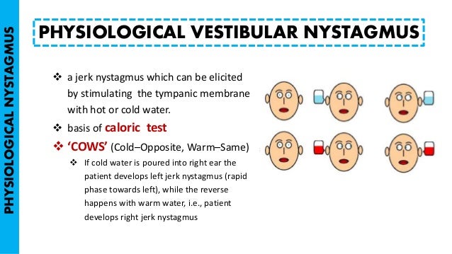 Nystagmus