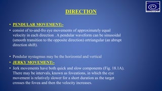 Nystagmus | PPTX