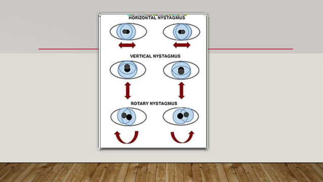 NYSTAGMUS.pptx | Eye and Vision Conditions | Diseases and Conditions