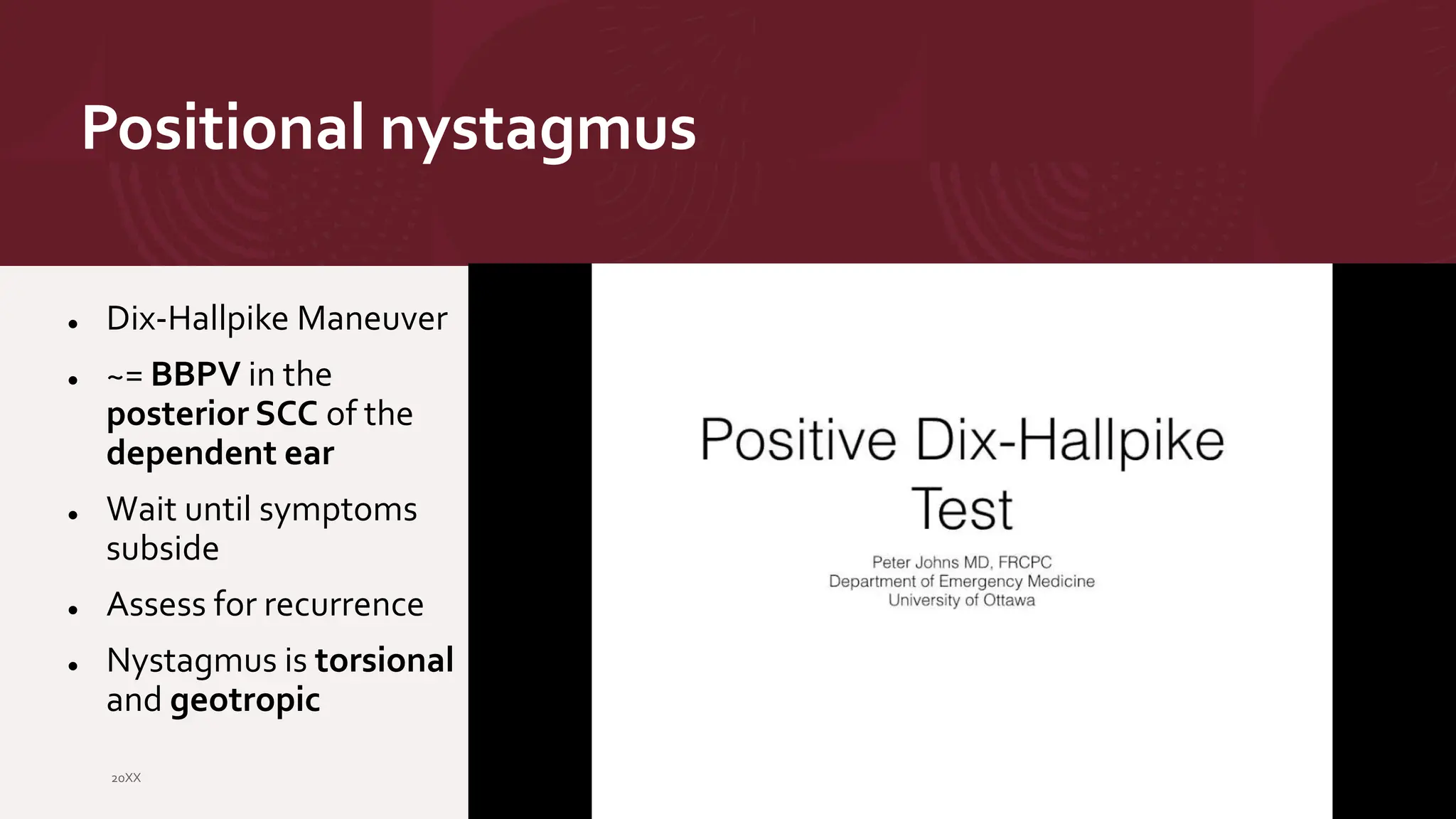 Vertigo and Nystagmus - Clinical approach part-2.pptx