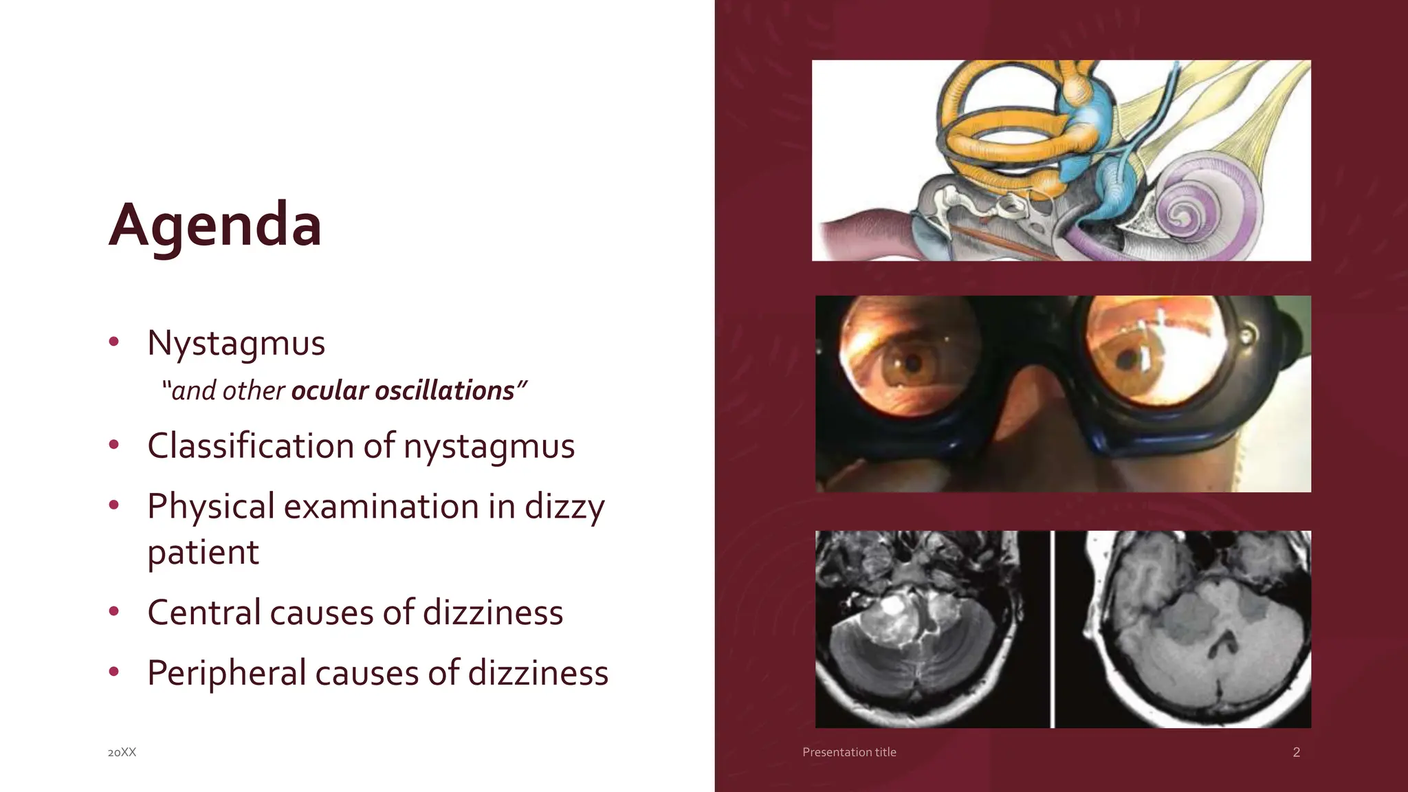 Vertigo and Nystagmus - Clinical approach part-2.pptx