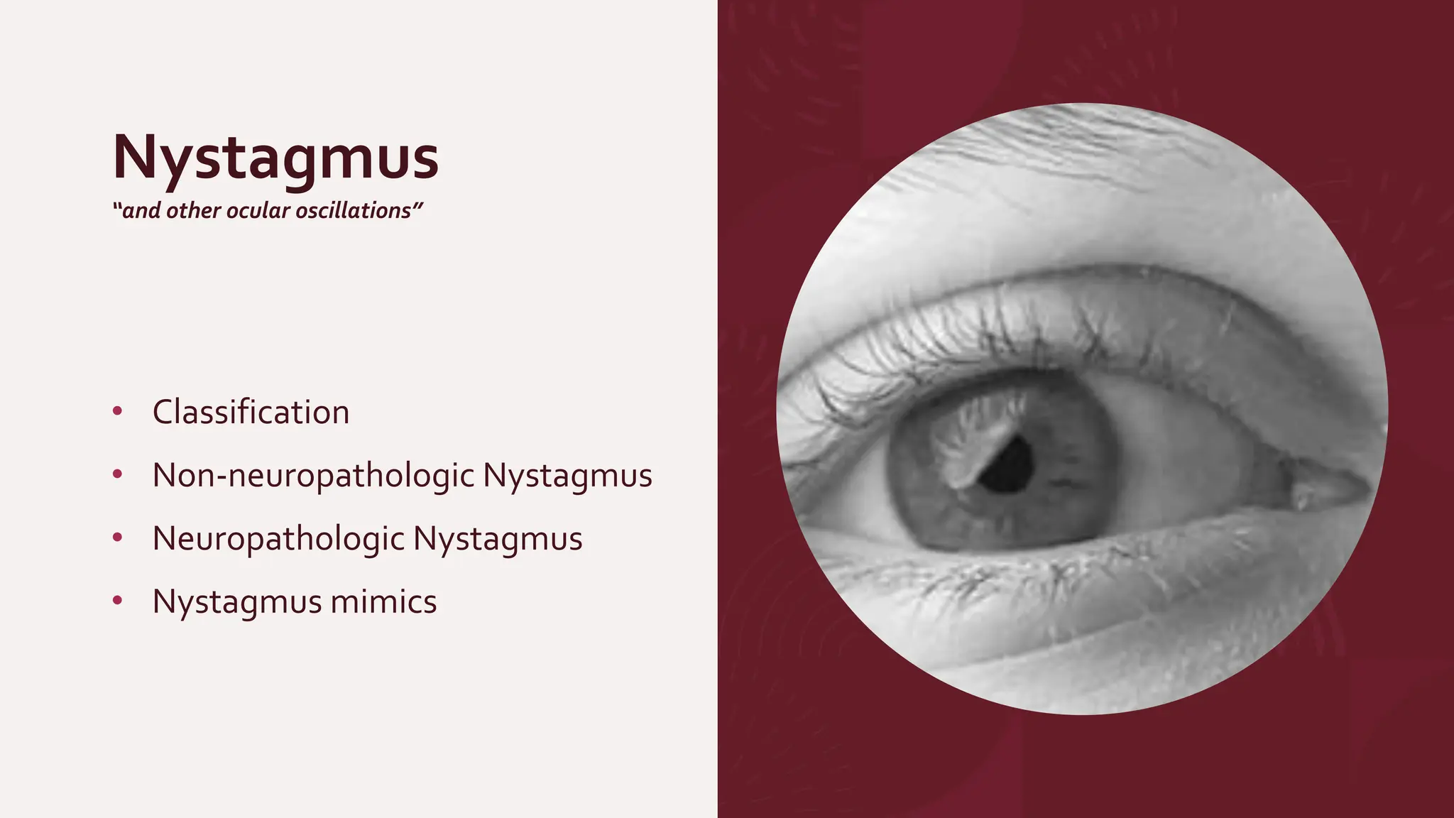 Vertigo and Nystagmus - Clinical approach part-2.pptx