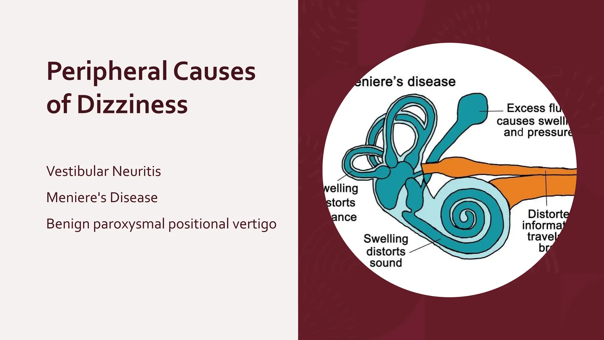 Vertigo and Nystagmus - Clinical approach part-2.pptx