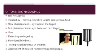 NYSTAGMUS In neurophthalmology by sreya c | PPT