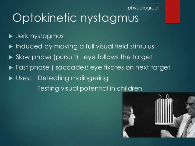 Nystagmus namrata