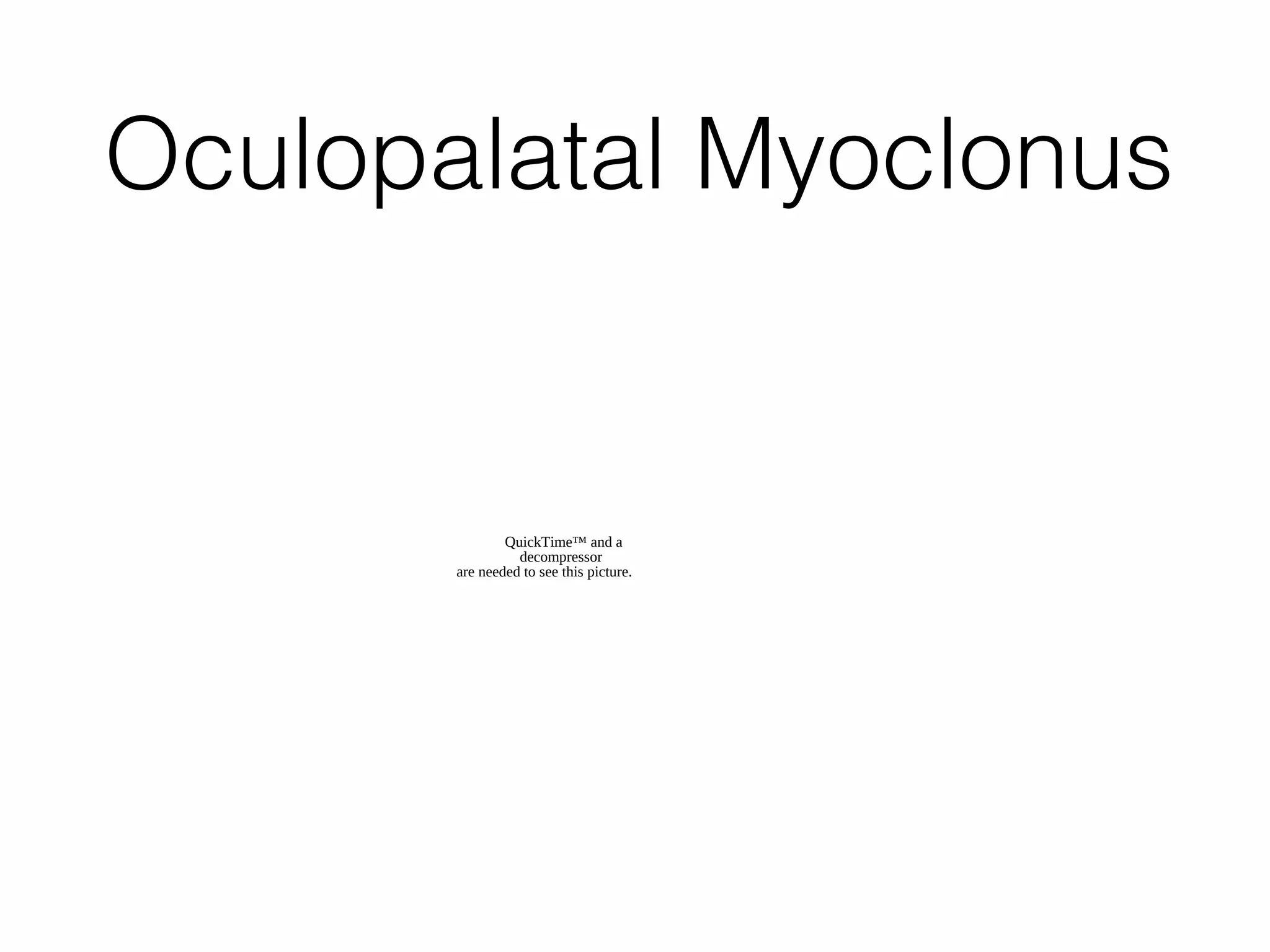 Nystagmus and Nystagmoid Movements | PPT