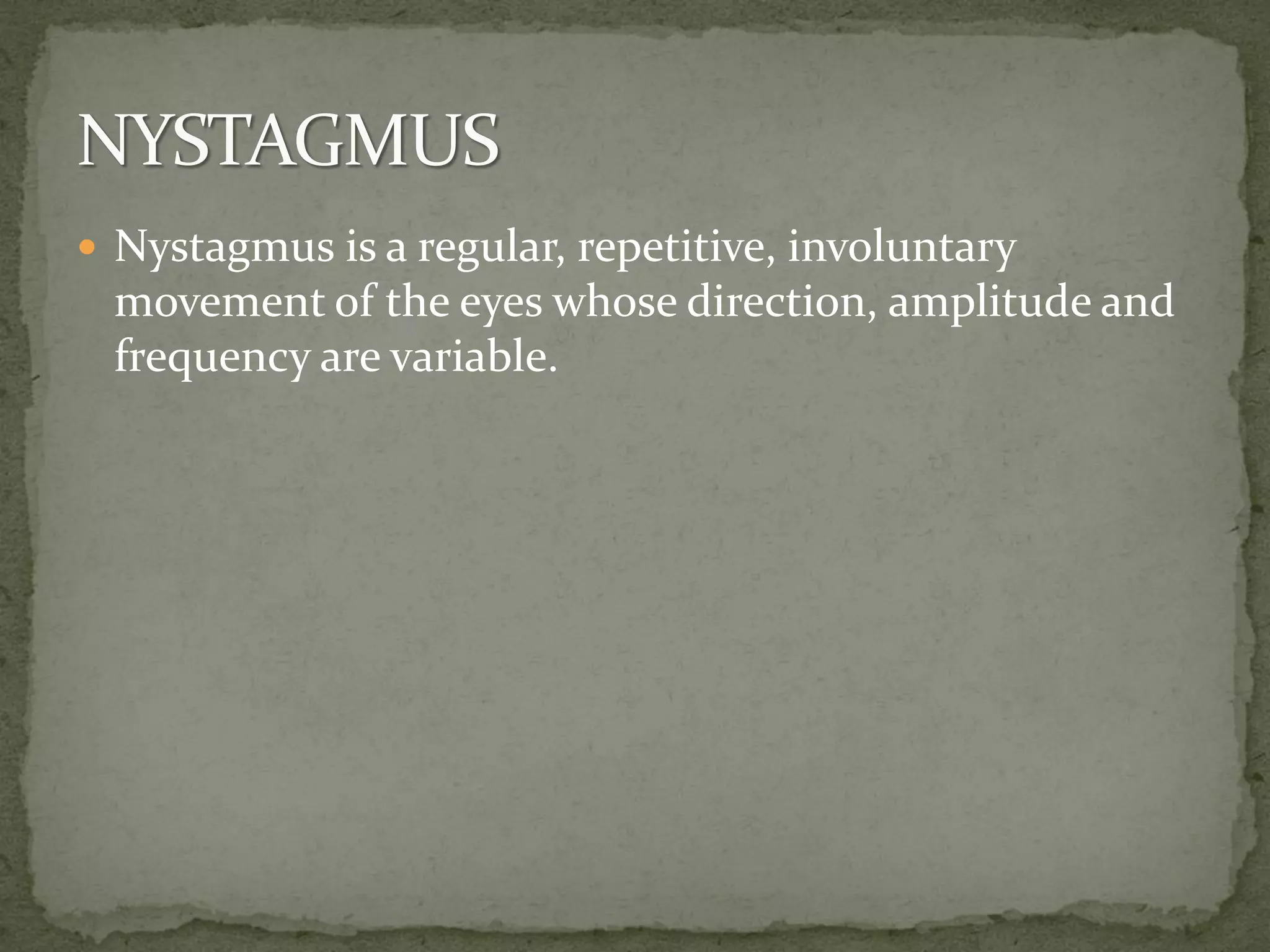 Nystagmus_3rd_year.pdf