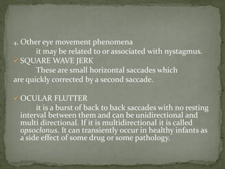 Nystagmus_3rd_year.pdf