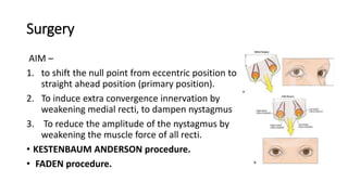 Nystagmus assessments and management mehedi | PPTX