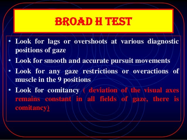 update of Nystagmus 14 11-2012