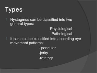 Nystagmus by yehia matter | PPT | Eye and Vision Conditions | Diseases ...