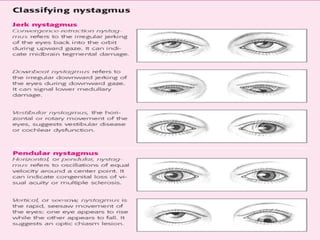 Nystagmus by yehia matter | PPT | Eye and Vision Conditions | Diseases ...