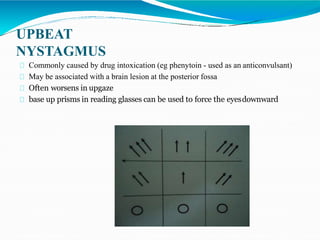 Nystagmus | PPTX