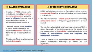 Dymystifying Nstagmus || Ms Anjali Ahuja | PPT