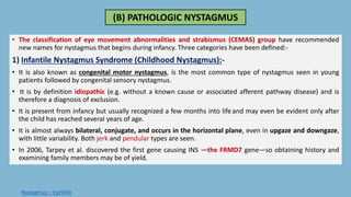 Dymystifying Nstagmus || Ms Anjali Ahuja | PPT