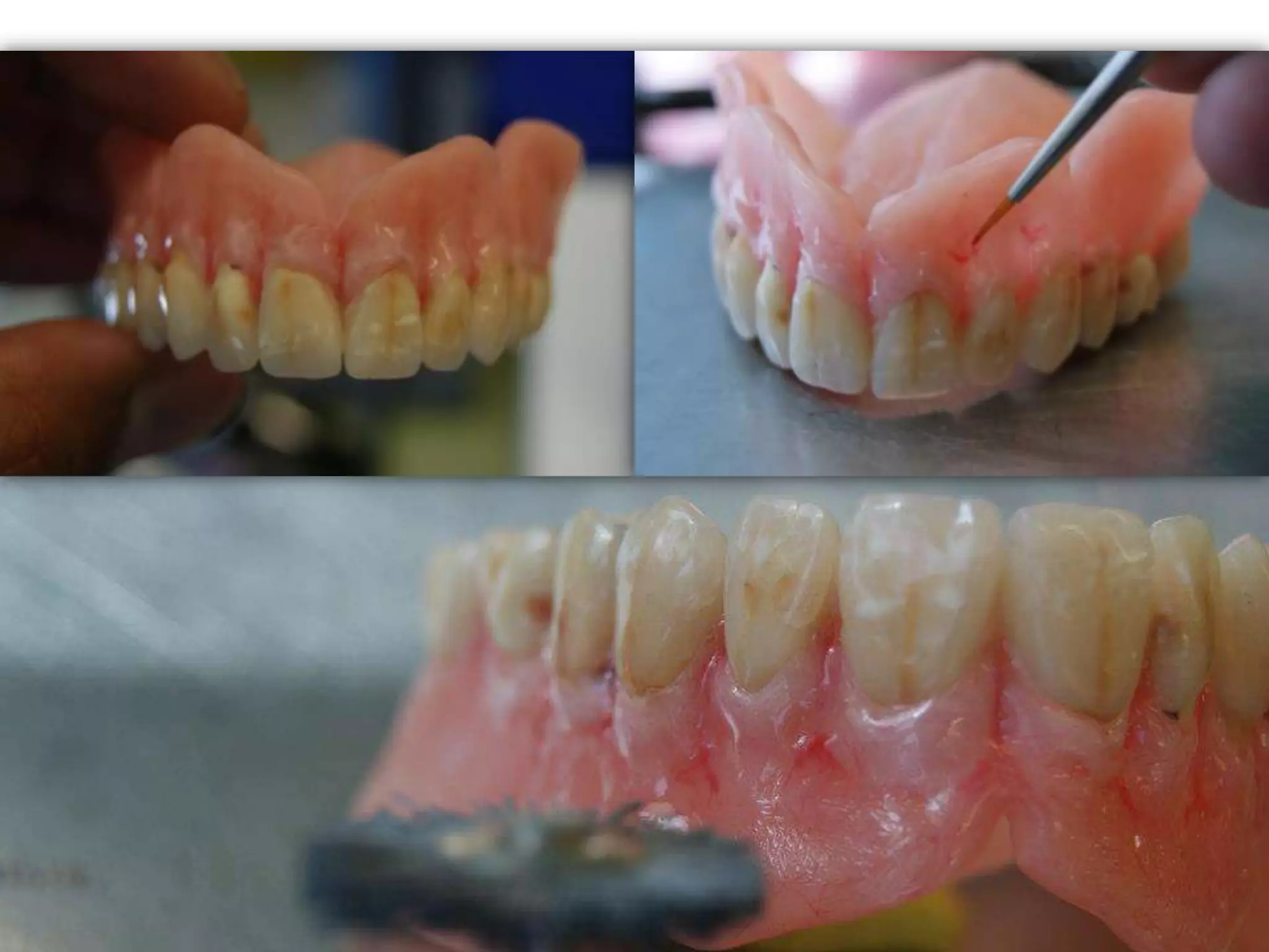 The negative space of the bite block. | PPTX