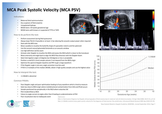 Bảng chỉ số PI Doppler động mạch rốn, động mạch não giữa, động mạch tử ...