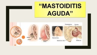 Otitis Media Aguda, Mastoiditis y Complicaciones.pptx