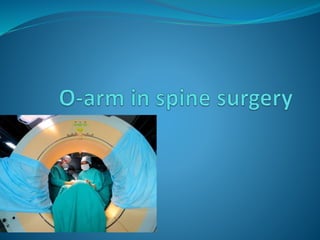 O -arm in spine surgery | PPTX