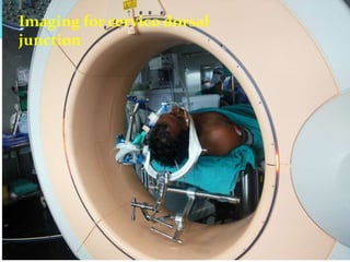 O -arm in spine surgery | PPTX