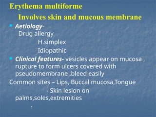 O-DISEASES OF BUCCAL CAVITY.ppt JFK JFK of | PPT
