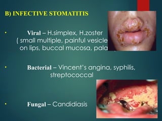DISEASES OF BUCCAL CAVITY in dentistry.ppt