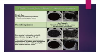 O-RADS Classification Of Ovarian Lesions | PPT