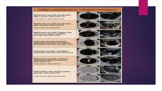 O-RADS Classification Of Ovarian Lesions | PPT