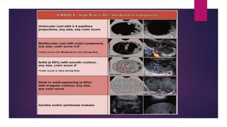 O-RADS Classification Of Ovarian Lesions | PPT