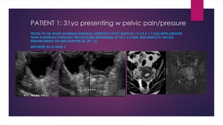 O-RADS Classification Of Ovarian Lesions | PPT