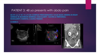 O-RADS Classification Of Ovarian Lesions | PPT