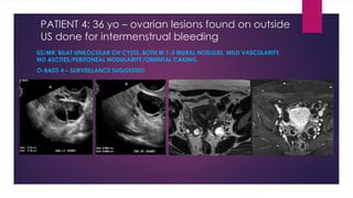 O-RADS Classification Of Ovarian Lesions | PPT