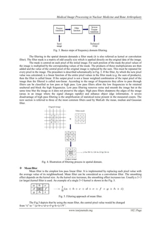 Medical Image Processing in Nuclear Medicine and Bone Arthroplasty | PDF