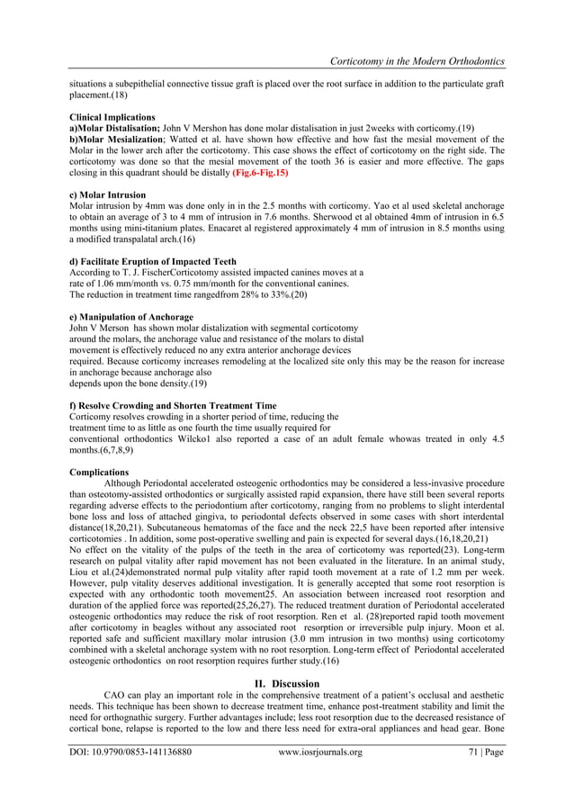 Corticotomy in the Modern Orthodontics | PDF