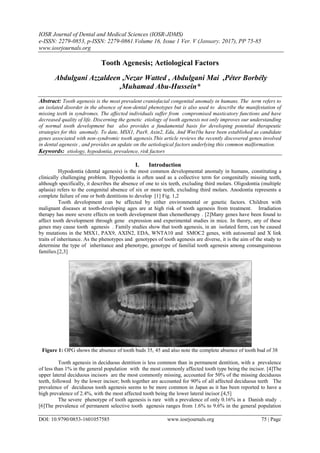 Tooth Agenesis; Aetiological Factors | PDF