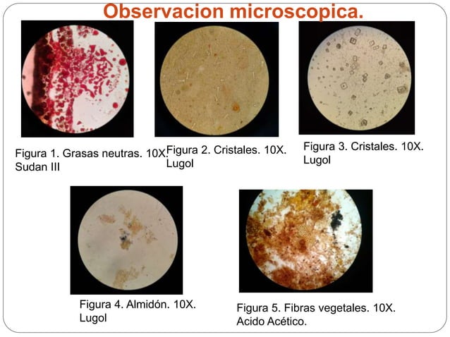 examen coproparasitoscopico y coprologico | PPT