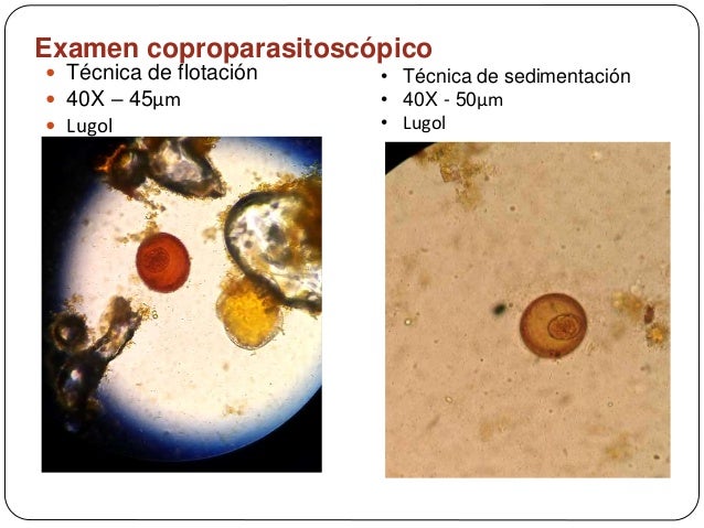 examen coproparasitoscopico y coprologico