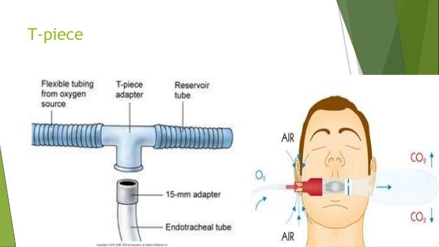 O2 therapy presentation