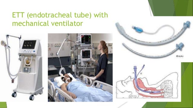 O2 therapy presentation